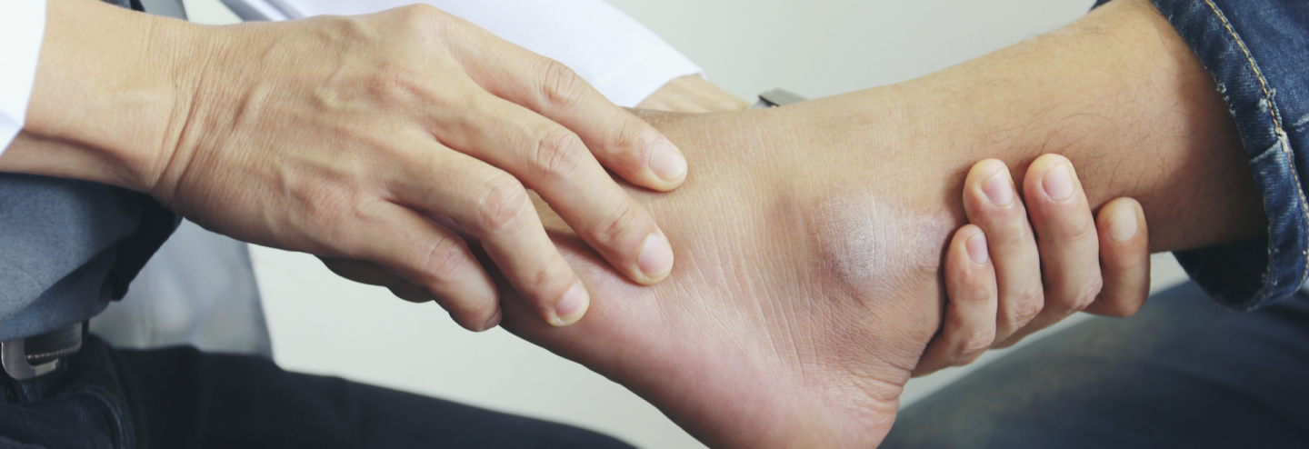 5 Things I’ve Learned About Gout - Gout Support Group of America